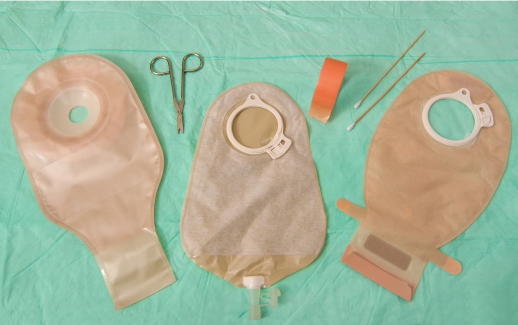 Mastering Ostomy Adhesion for Ostomy Nurses | Skinister Medical