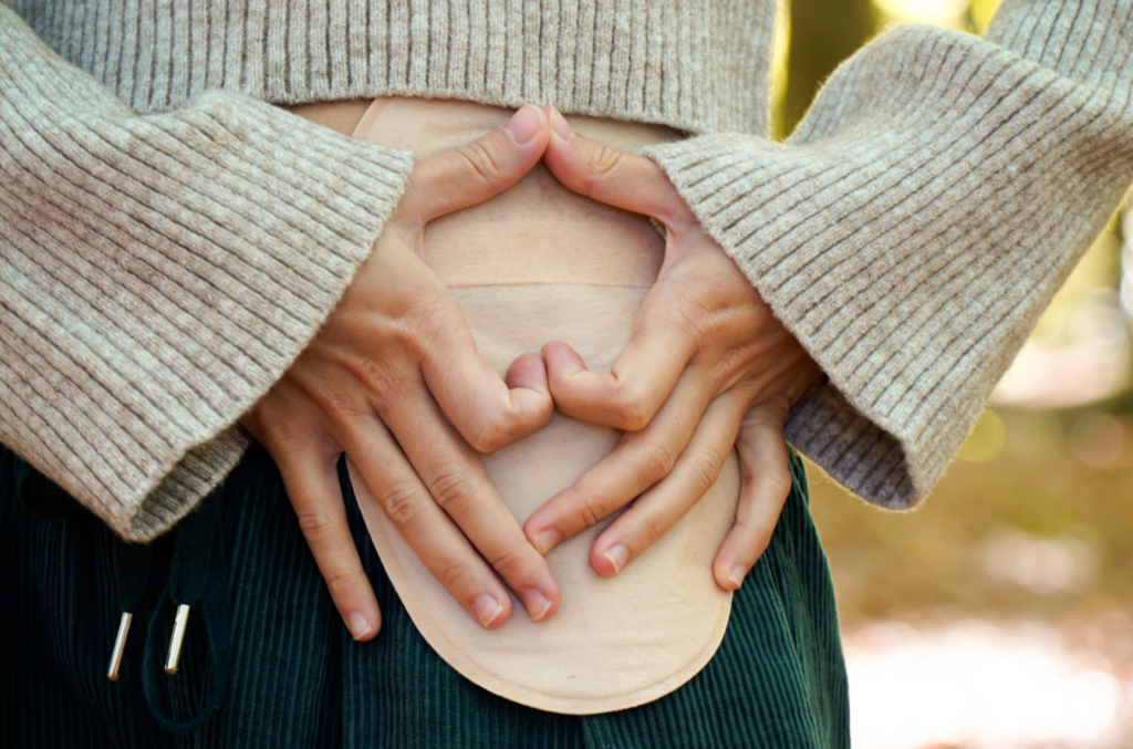 Mastering Ostomy Adhesion for Ostomy Nurses | Skinister Medical